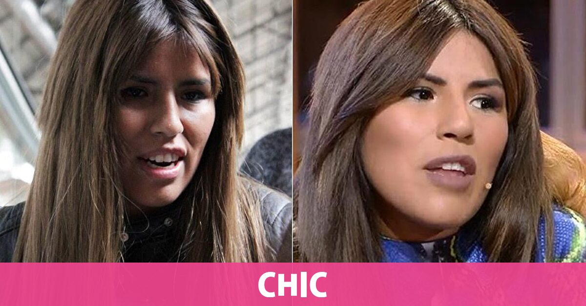 ¿Qué se ha hecho Chabelita en la cara? - Chic