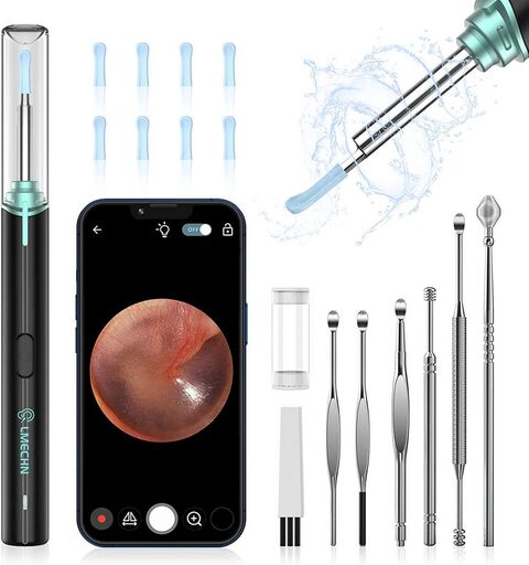 Los 9 mejores otoscopios para para cuidar la salud de tus oídos