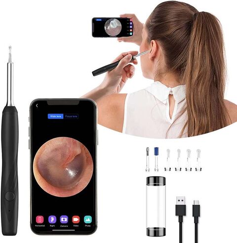 Los 9 mejores otoscopios para para cuidar la salud de tus oídos