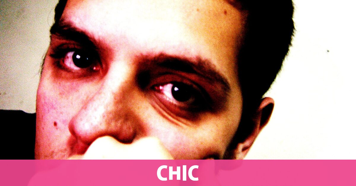 Causas de las ojeras y cómo eliminarlas