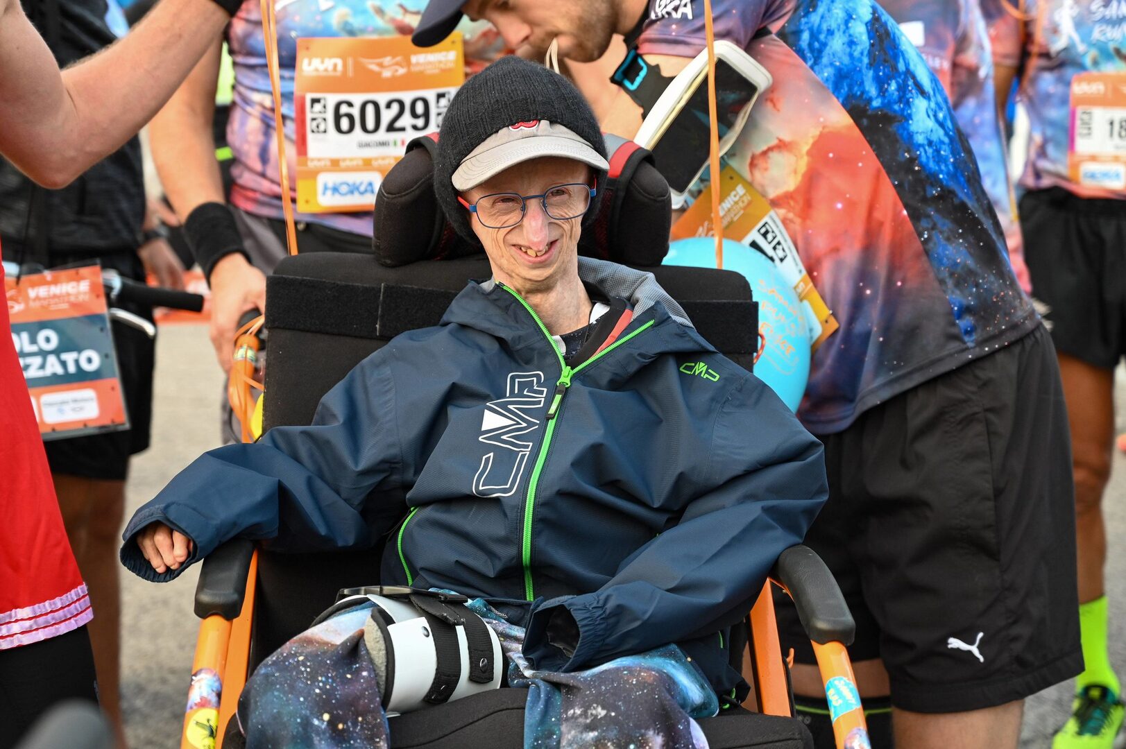 El adiós a Sammy Basso, la persona con progeria más longeva del mundo ...