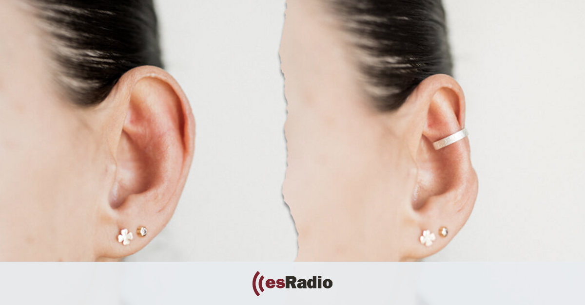 Belleza: Earmod, la solución para las orejas de soplillo - esRadio
